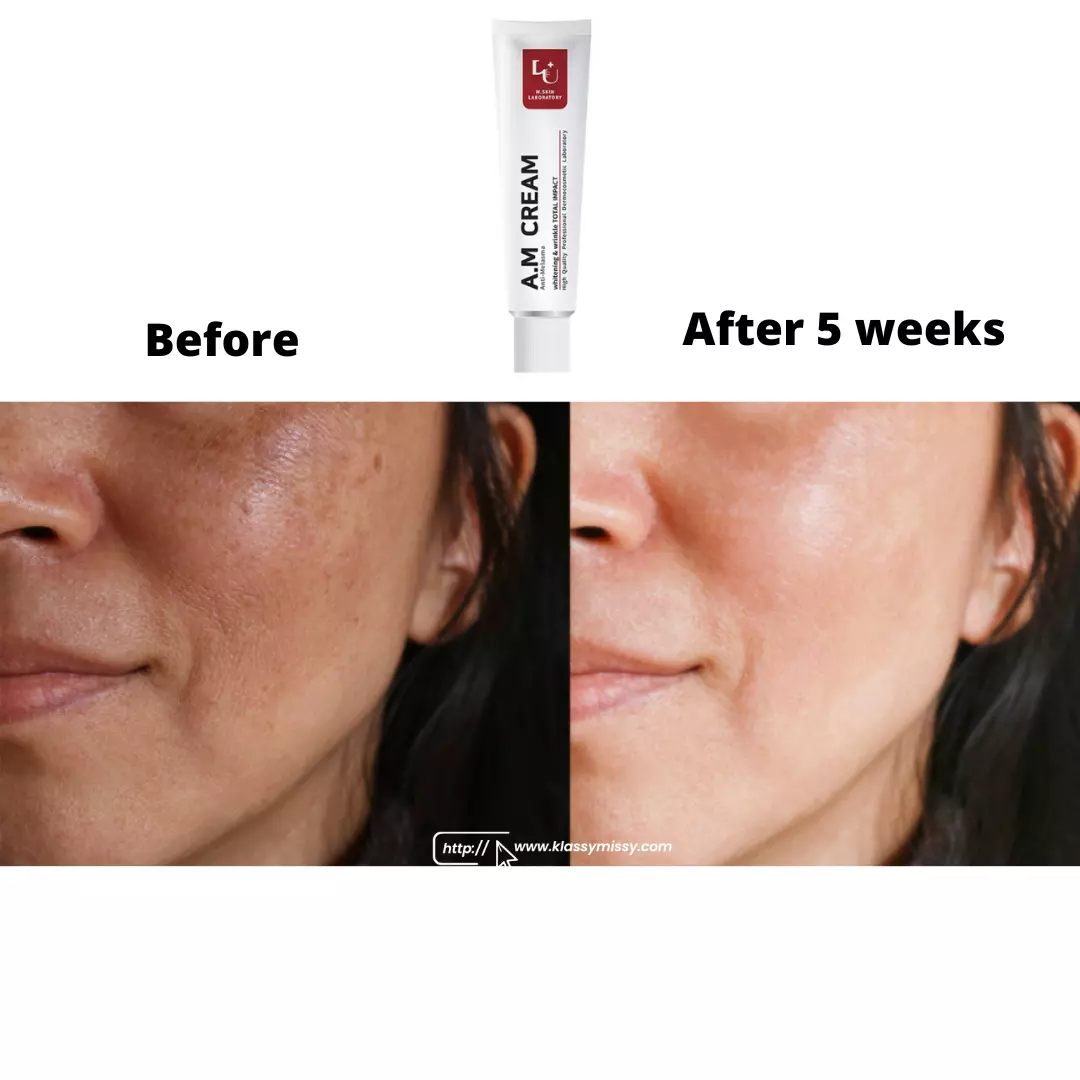 W.Skin Laboratory A.M Cream Anti-Melasma 50ml